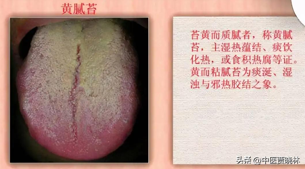 Hot cough spit yellow phlegm; - iNEWS