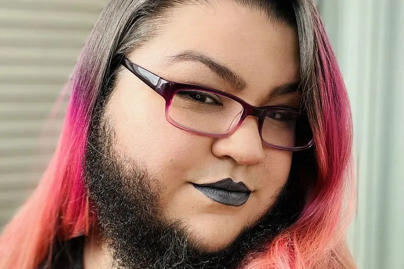 The woman has a strong beard and insisted on shaving for 16 years, but ...