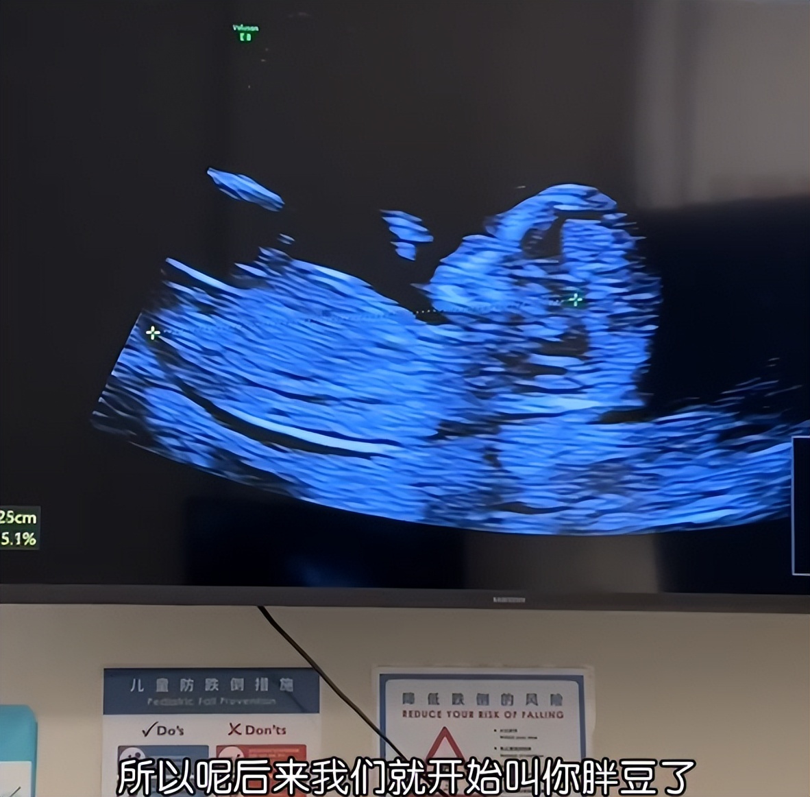 Cheng Xiaoyue released the production screen, the baby is oversized and ...