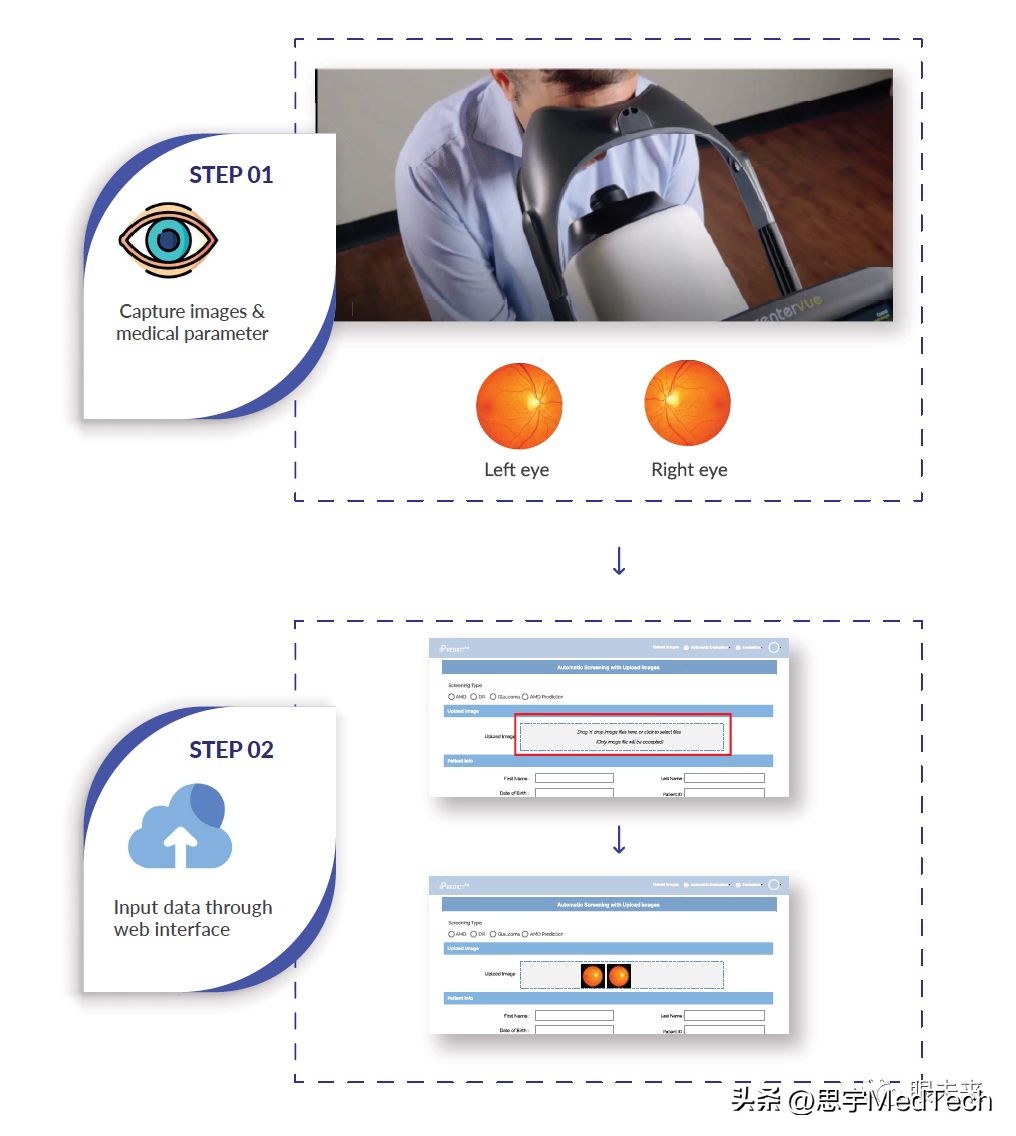 It only takes 5 minutes! Artificial Intelligence Eye Screening System ...