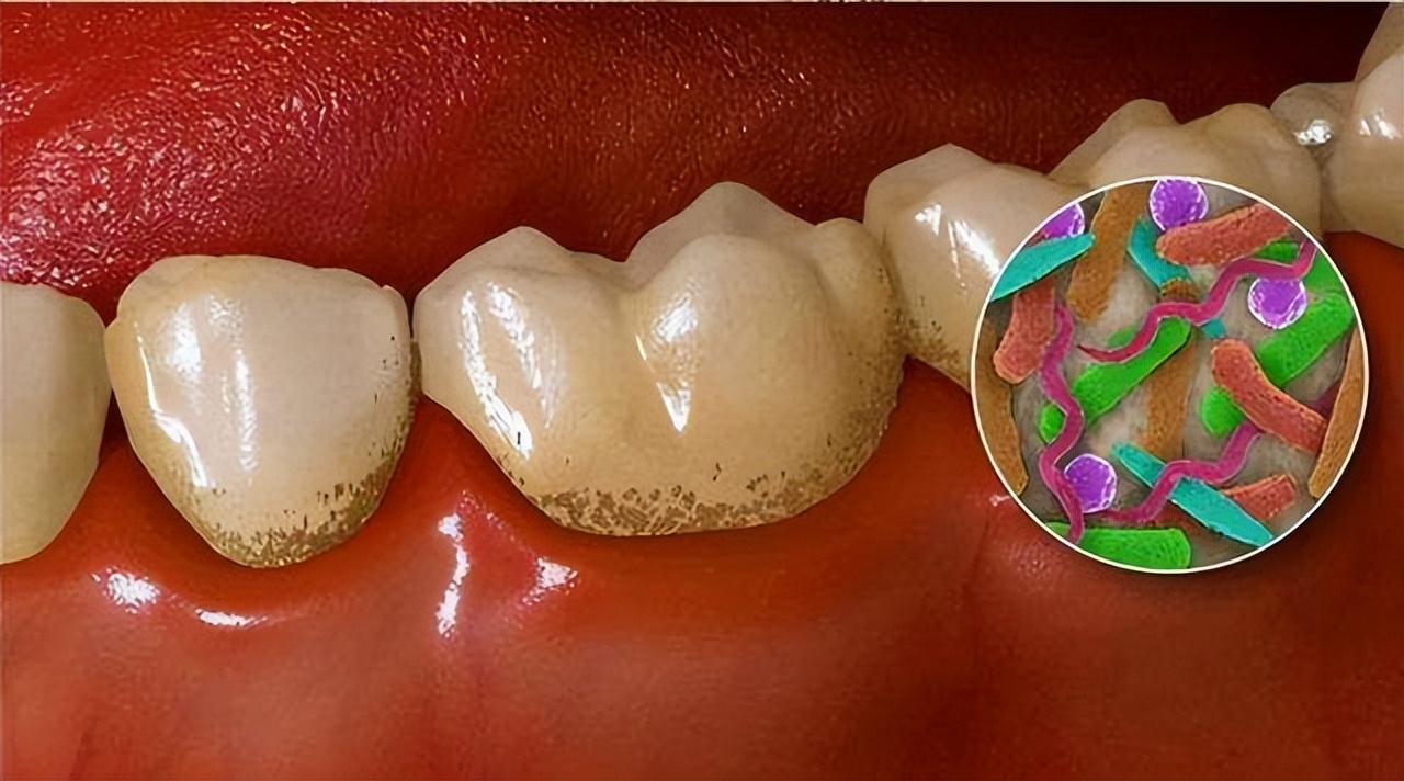 Why can't I smell something stinky from my teeth? - iNEWS