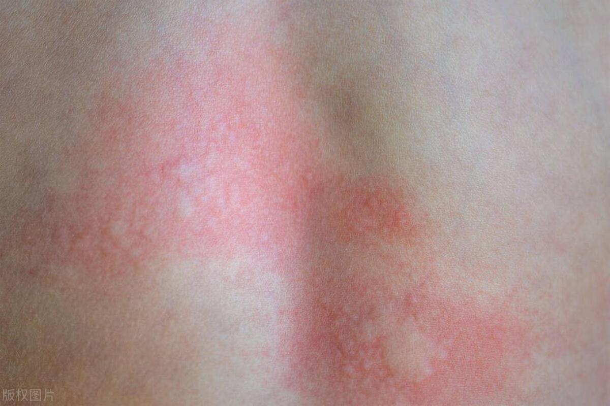 Are Abnormal Legs a Signal of Cancer? Doctor: These 3 abnormalities ...