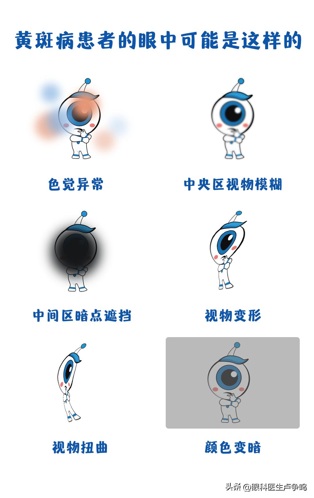 [Inventory] Signs of eye diseases that make many highly myopic eyes ...