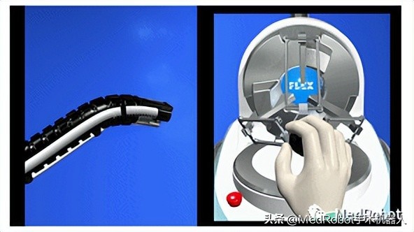 Transnatural Orifice Surgery Robot Flex - iNEWS