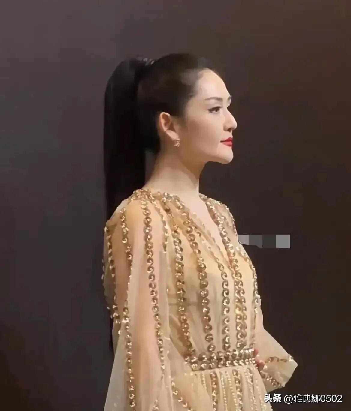 Xie Na and Zhang Jie, the "Runtu couple", have also started plastic surgery to change their ...