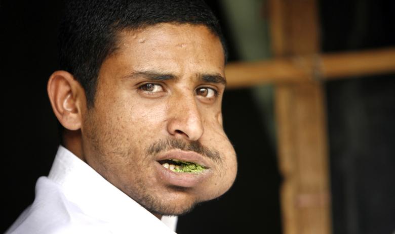 Yemen destroyed by khat grass: 70% of the nationals use drugs as snacks ...