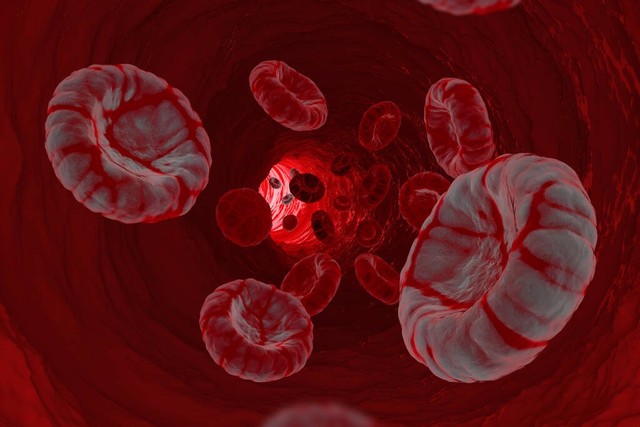 What do you know about leukemia? - iNEWS