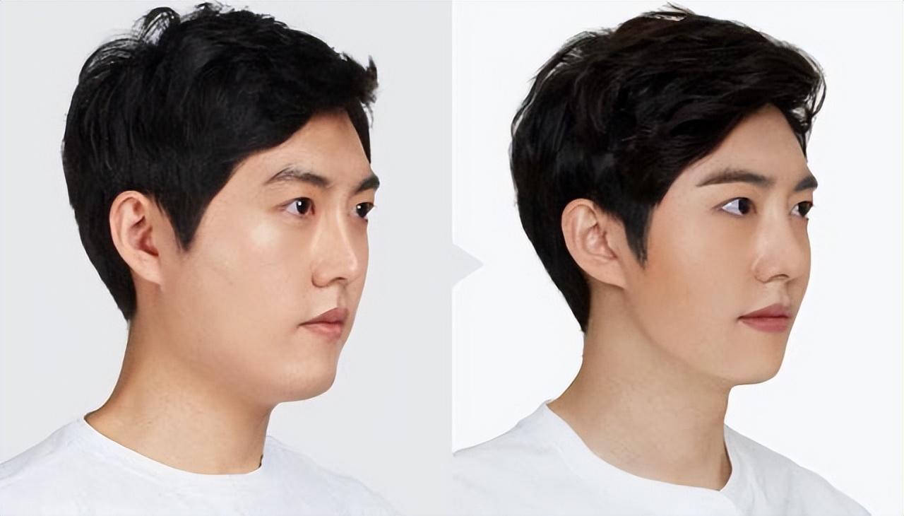 What is so special about a boy's "Adam's Apple"? Why can't girls just ...