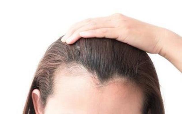 What is the high cranial top and the head covering the face? - iNEWS