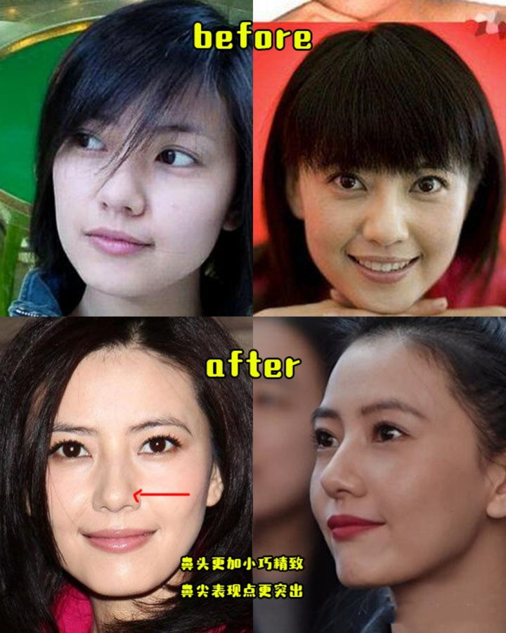 "Fake nose" awards in the film and television industry: who is the ...