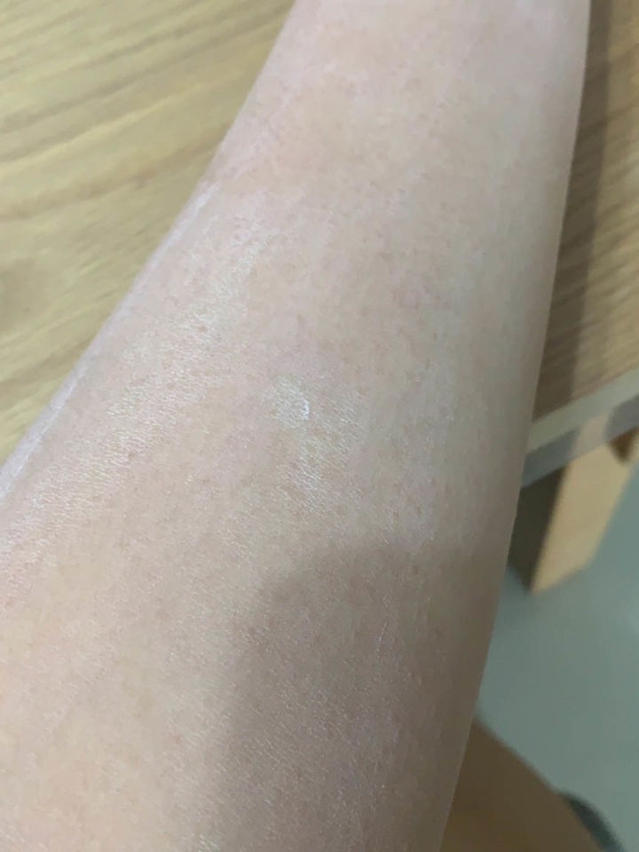 100 days to record the disappearance of fat lines!Listen to my advice ...