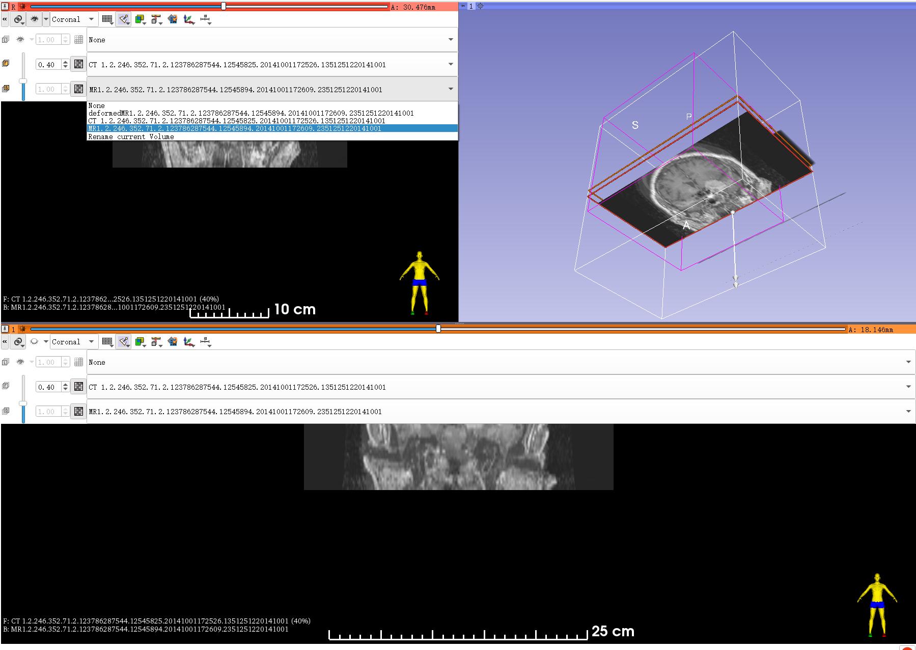 3DSlicer中查看配准後的多模態Dicom序列 - 資訊咖