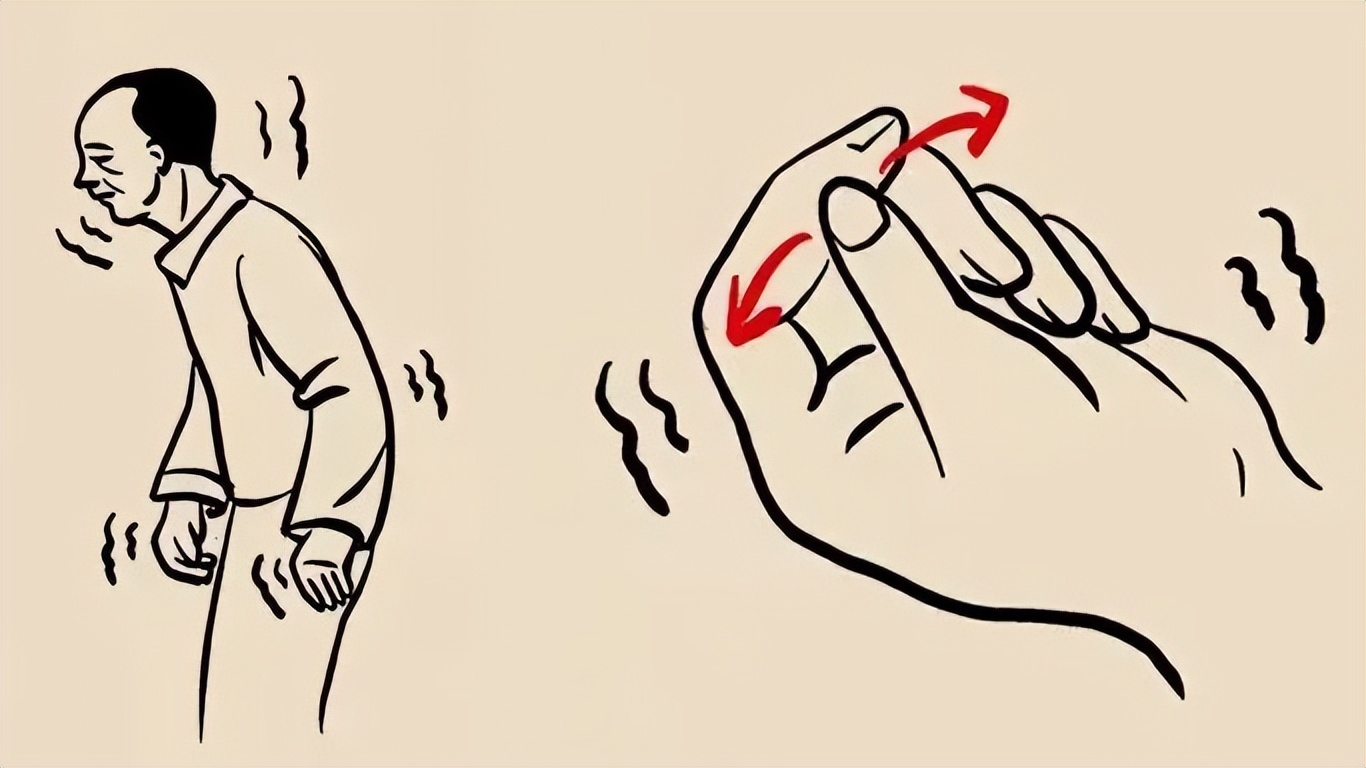 Attention elderly people at home!3 small ways to self-test Parkinson's ...