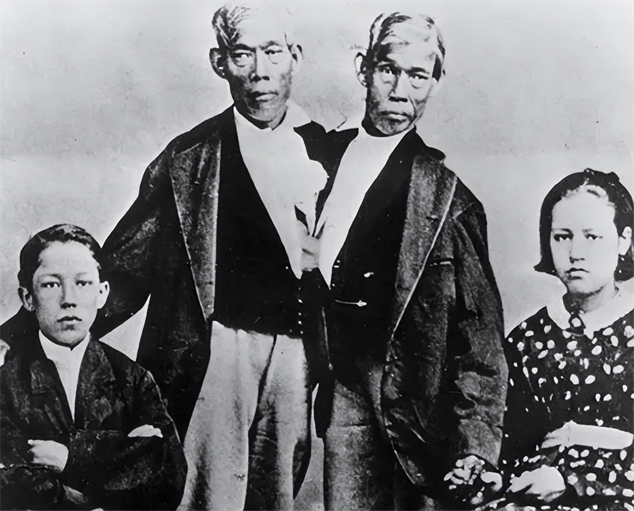 Chinese "Conjoined Twins" made a fortune in the United States, married ...