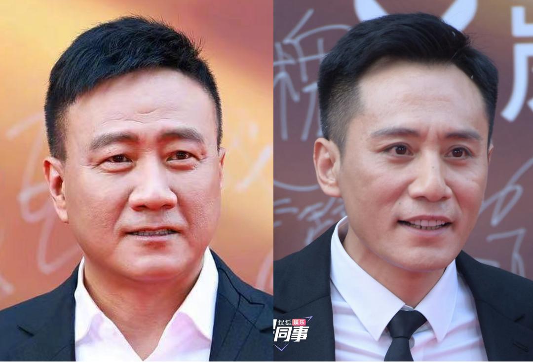 The male star under the face-to-face picture, with a swollen face and ...