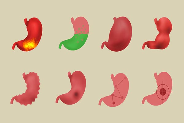 Does the stomach really get bigger and bigger and smaller when you get ...