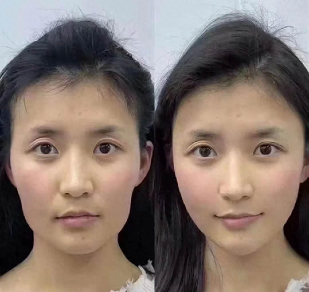 "Sunken face" is the main culprit of aging, and celebrities also suffer ...