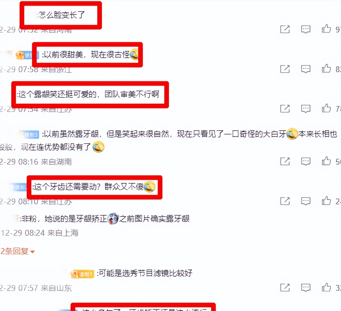 Xu Mengjie's plastic surgery failed?Attending the event, the face was stiff, and netizens said ...