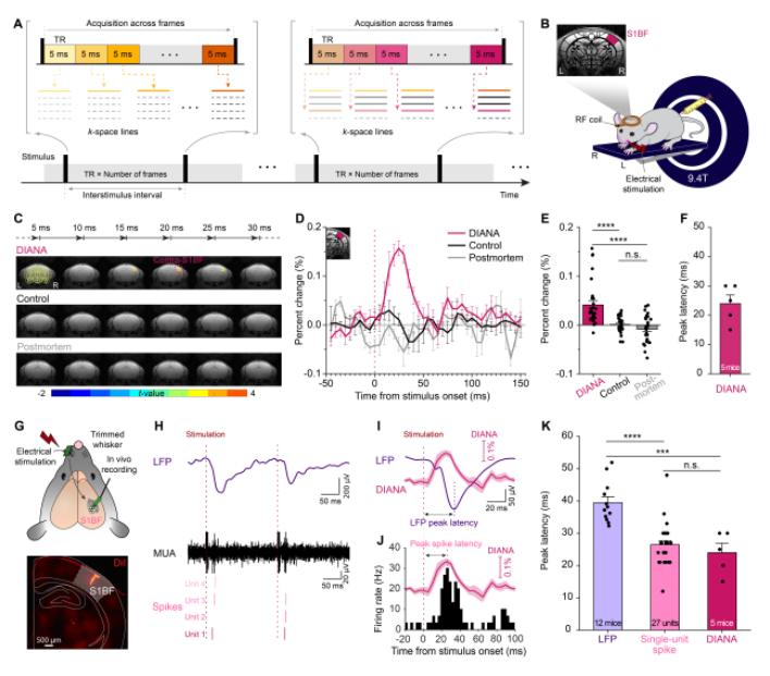 Neuroimaging ushered in reform, South Korean scientists achieved direct ...
