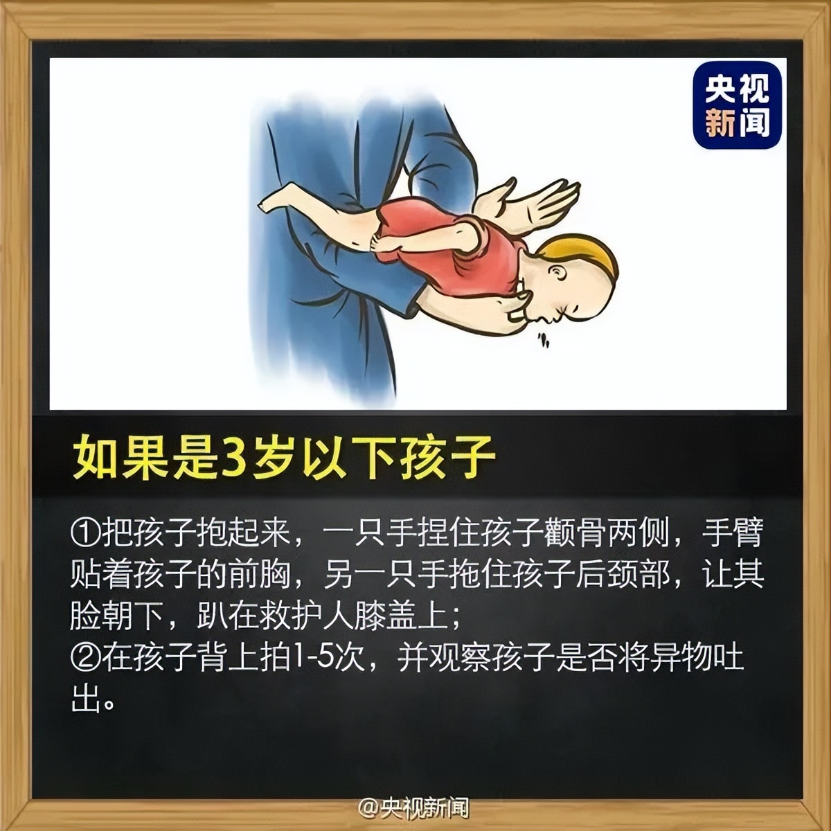 August baby swallows banana, Heimlich method fails!Learn this first aid ...