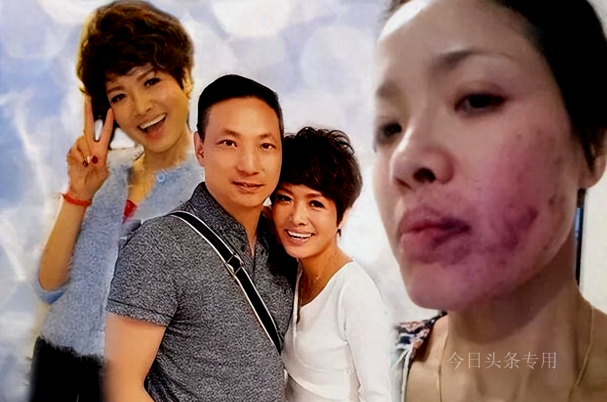 TVB disfigured actress goes bankrupt: She can't even afford food, so ...