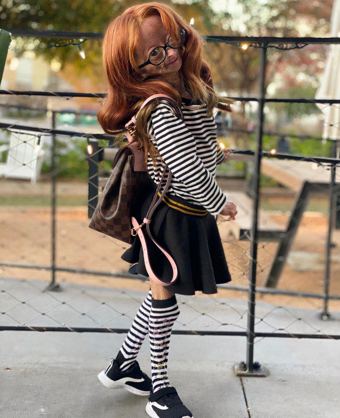 Well-known Internet celebrity Adalia Ross died of progeria at the age ...