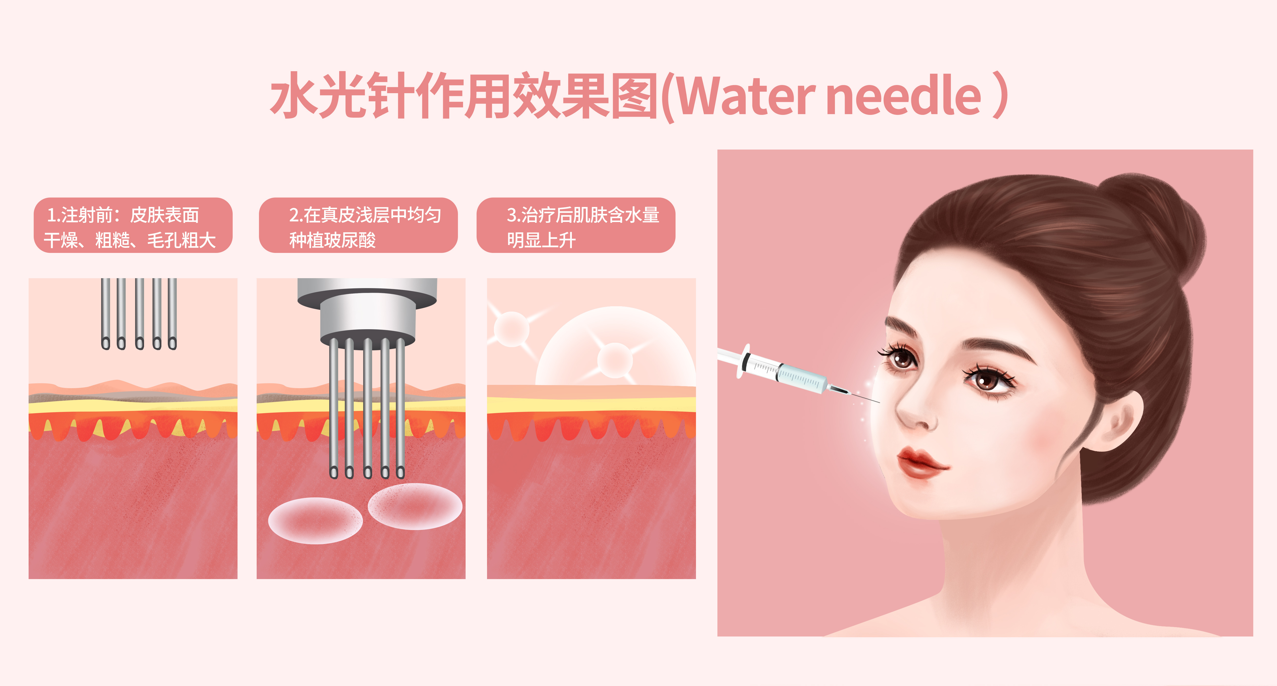 Why do you want to get a water injection?Will there be side effects ...