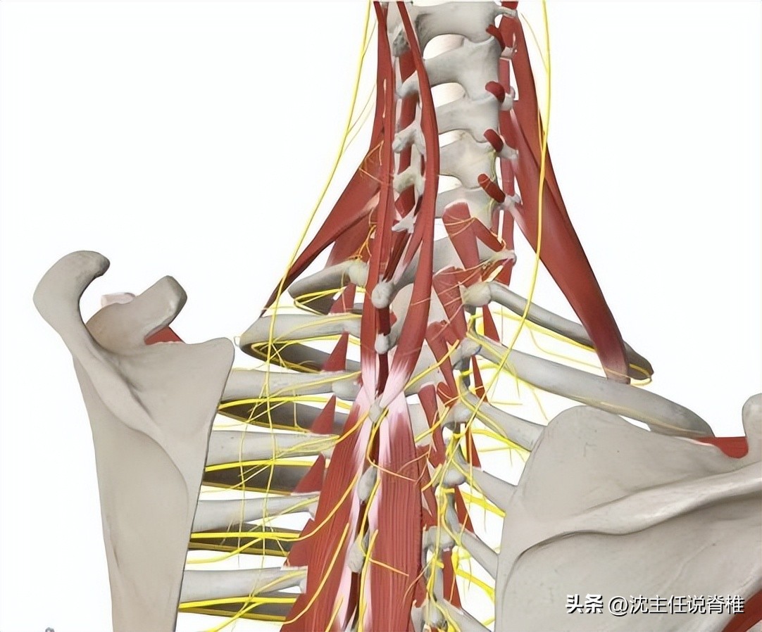 Shoulder and neck pain, is the lesion in the neck or the shoulder? - iMedia