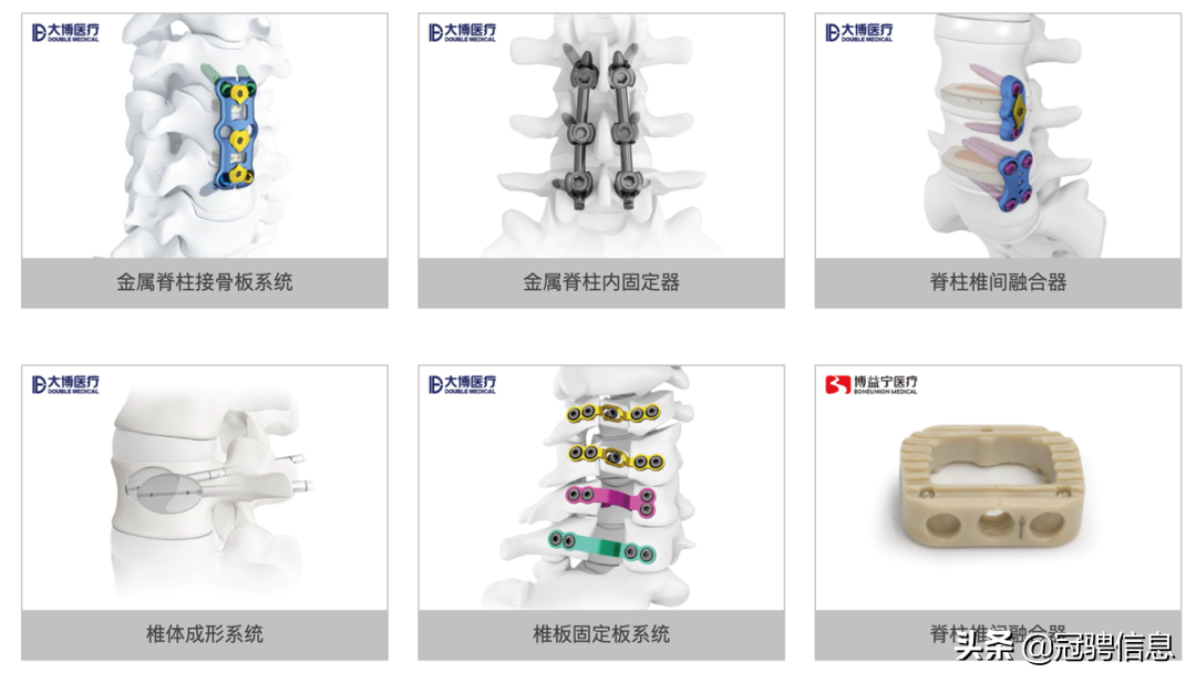 Analysis of Medical Device Orthopedic Consumables Industry (Part 1) - iNEWS