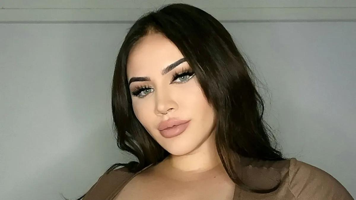 Rare form of macromastia caused Australian woman's bust to balloon by ...