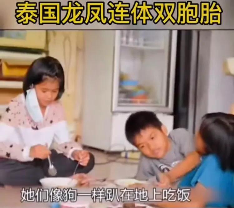 Rare conjoined twins in good condition - iNEWS