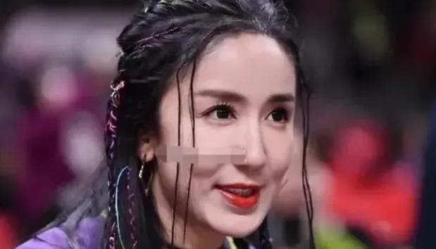 34-year-old Lou Yixiao's "plastic surgery" caused controversy, her face was swollen and stiff ...