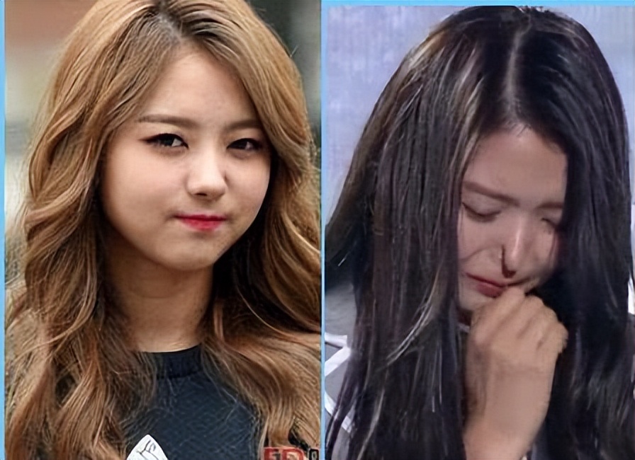 How scary is it that female stars have excessive plastic surgery? - iMedia