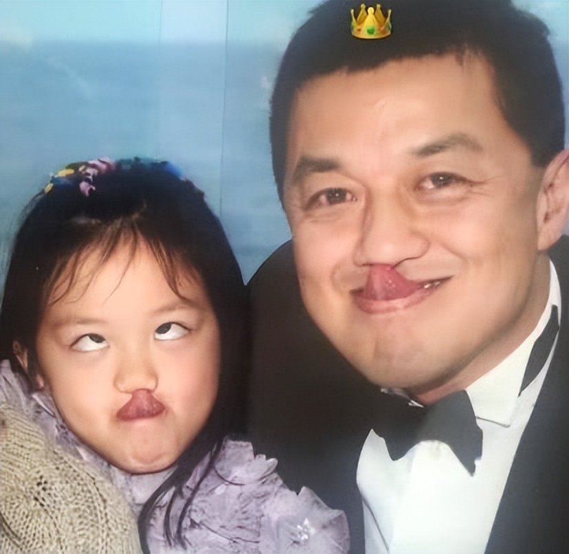 Li Yan has a cleft lip and palate, and Xia Xia frequently appears in ...