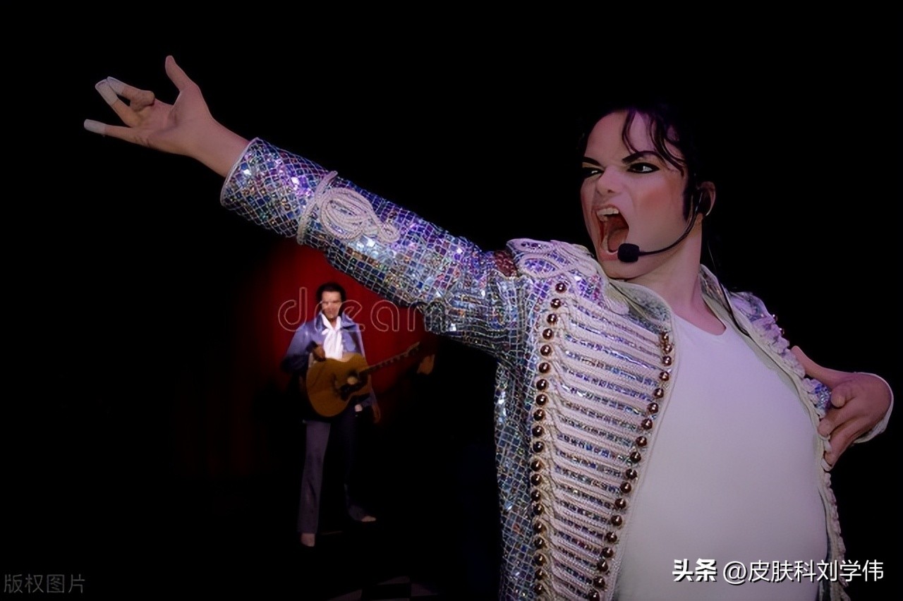 Michael Jackson bleached white? wrong! because he has vitiligo - iMedia