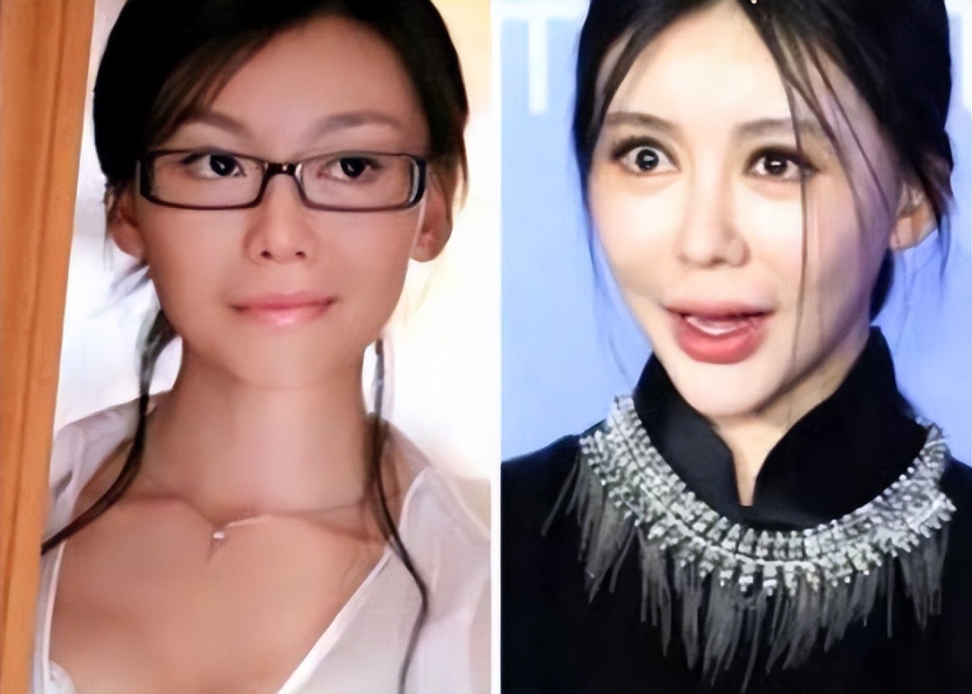 Four actresses who suffered "miserable harm" from plastic surgery, some ...