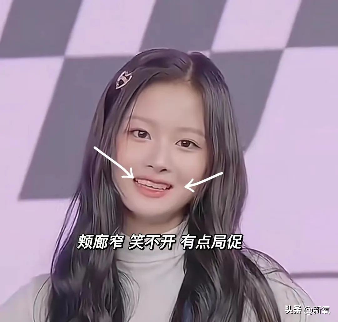 Xue Yun's orthodontics contrast before and after! Why do celebrities ...