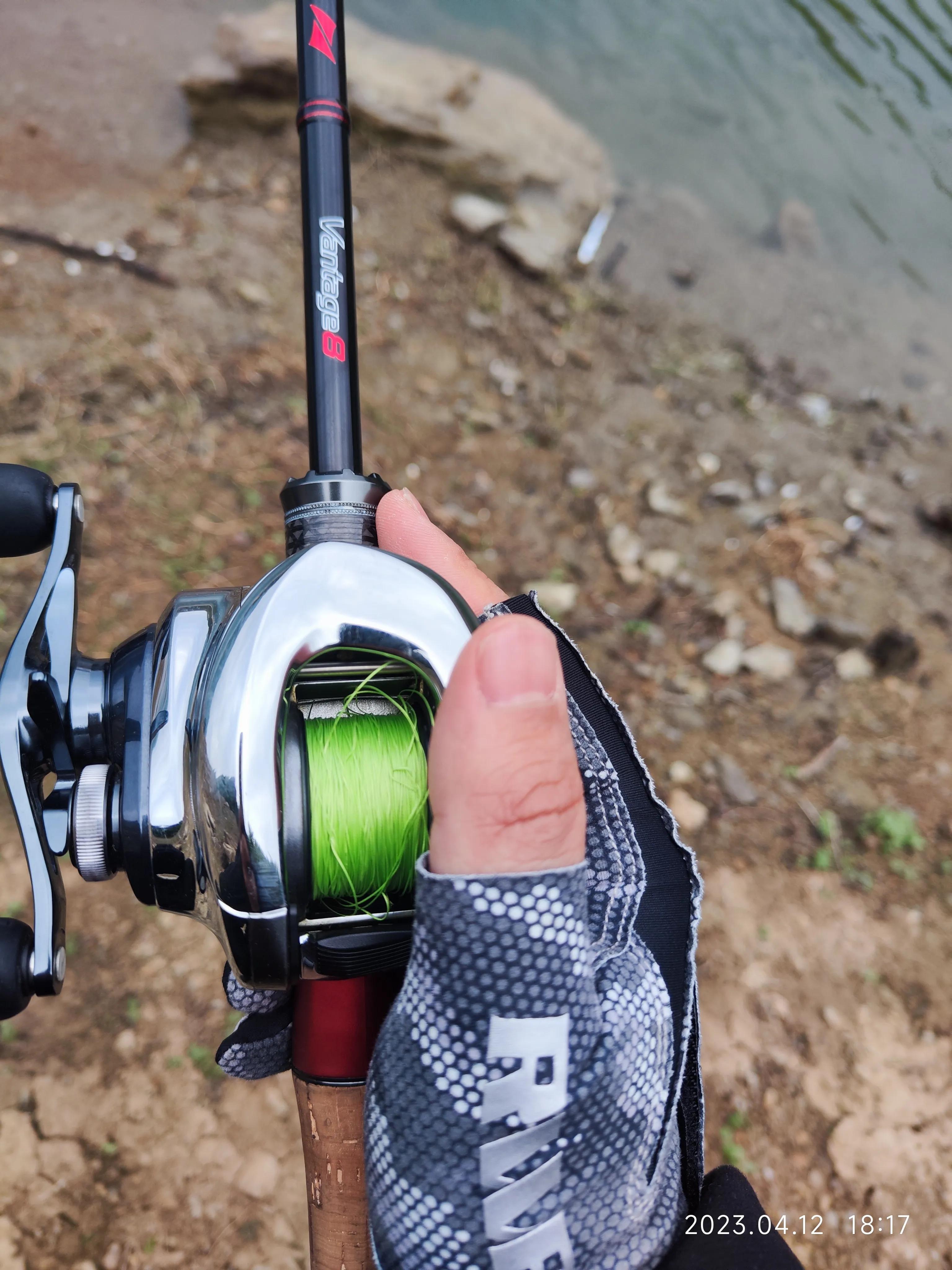 The documentary of a patient with lumbar disc herniation (108) - iNEWS