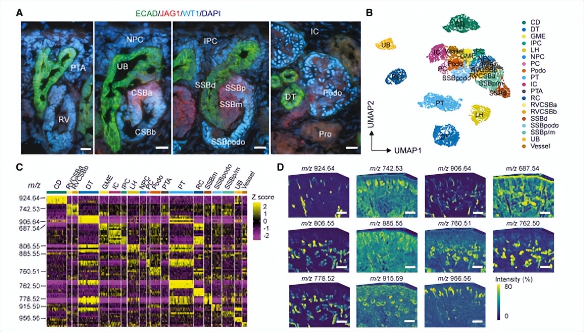 Single-cell transcriptomics + spatial metabolomics identify metabolic ...