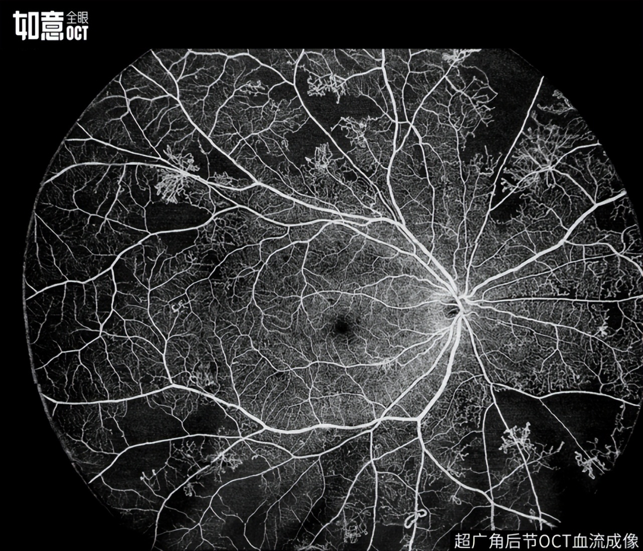 Whole-axis visualization biometrics and OCT are perfectly integrated ...