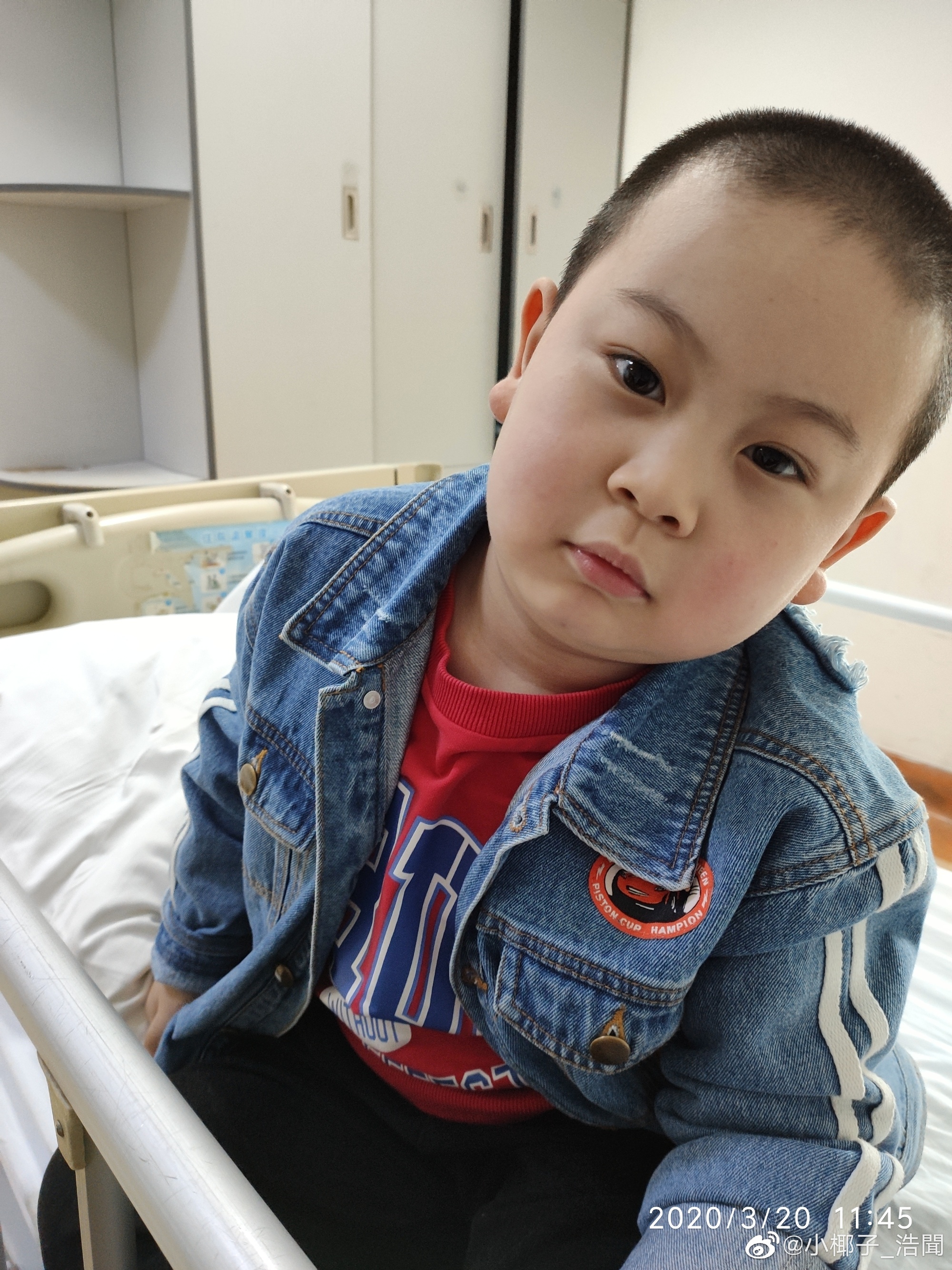 Children's experience of adenoid surgery and comparison before and ...