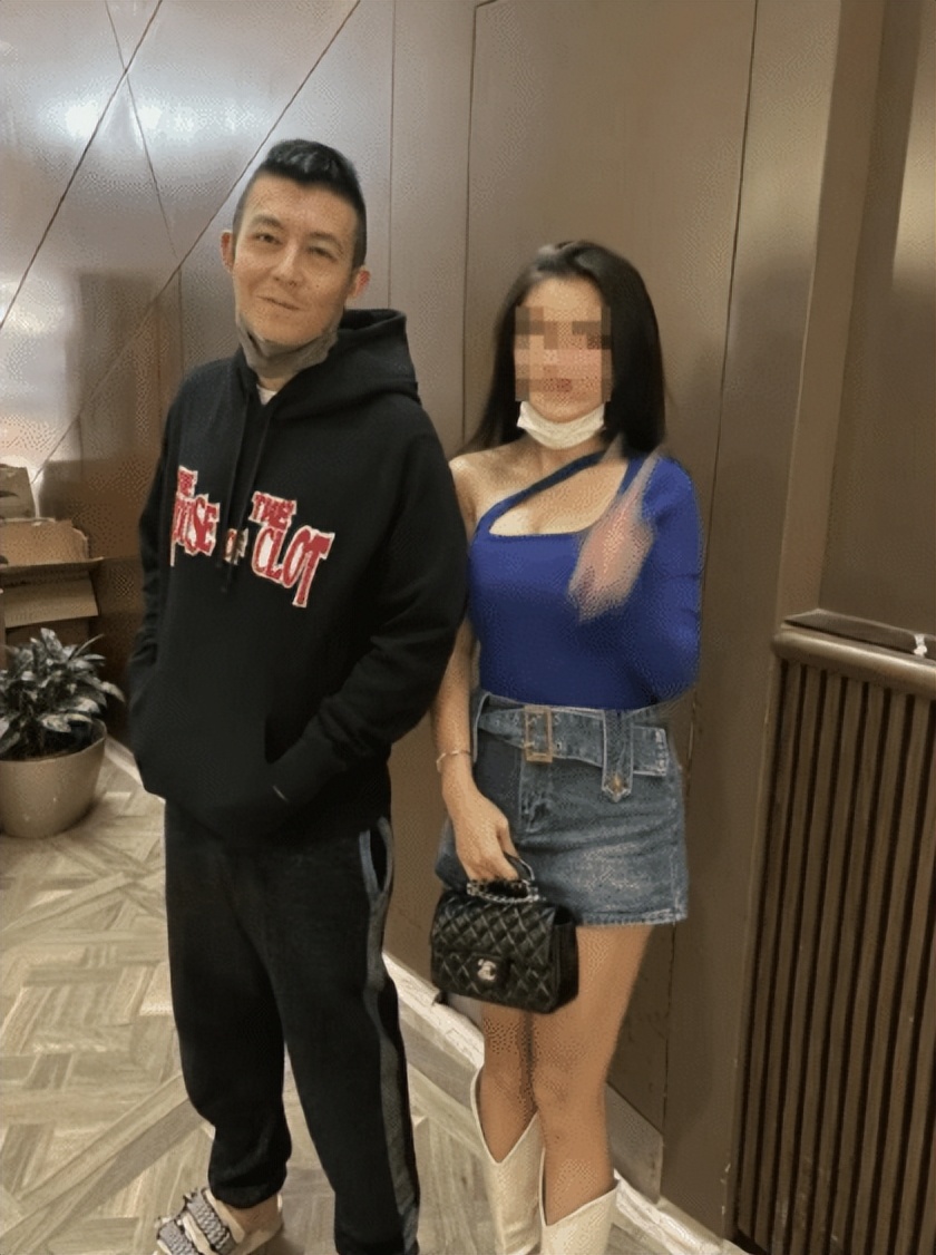 Hair loss, baldness, and deformed body, these 6 handsome guys were all ...