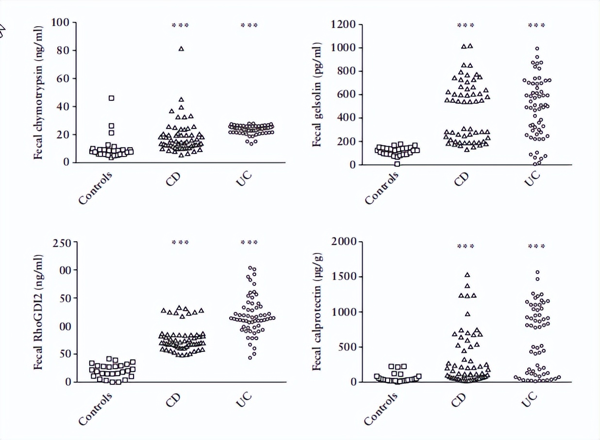 'Green Cancer' Inflammatory Bowel Disease Proteomics Discovers 3 Fecal ...
