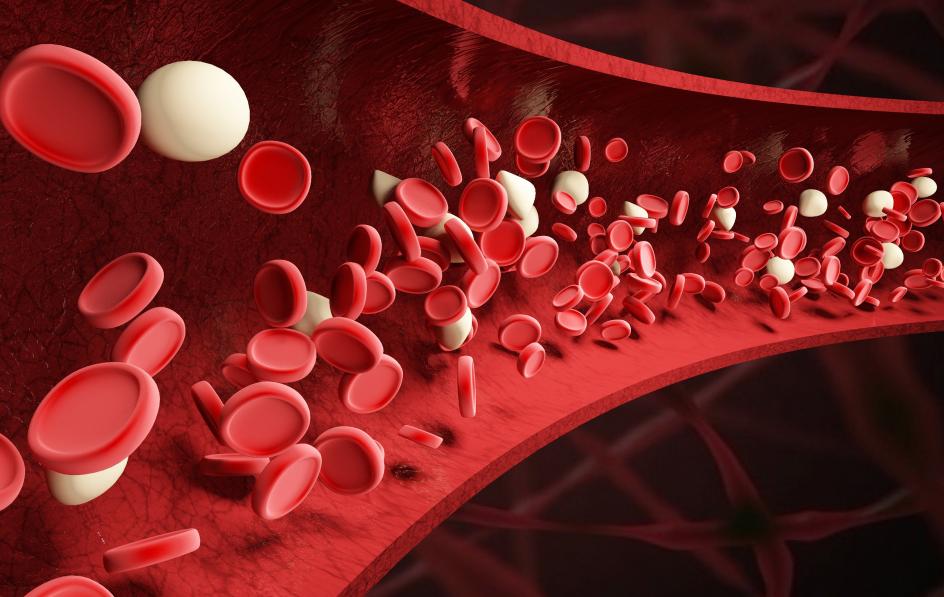 What's up with the cracked tongue?Where is the problem in the body?One ...