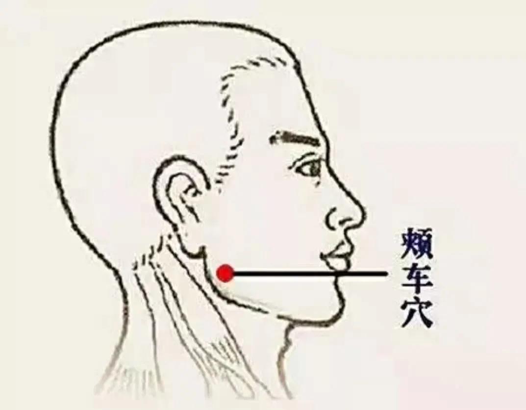 Acute and chronic pain conditioning - buccal acupuncture - iNEWS