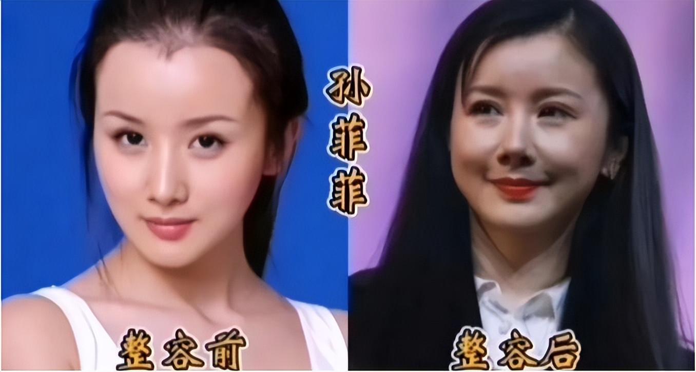 Comparing actresses before and after plastic surgery, Li Bingbing and ...