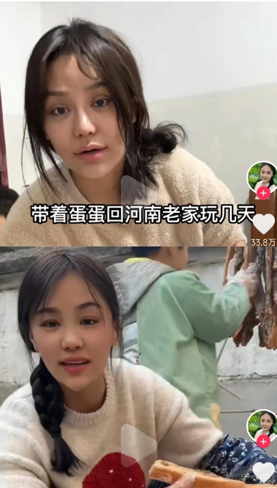 Accused of being in a trance! Fan Xiaohui went for plastic surgery ...