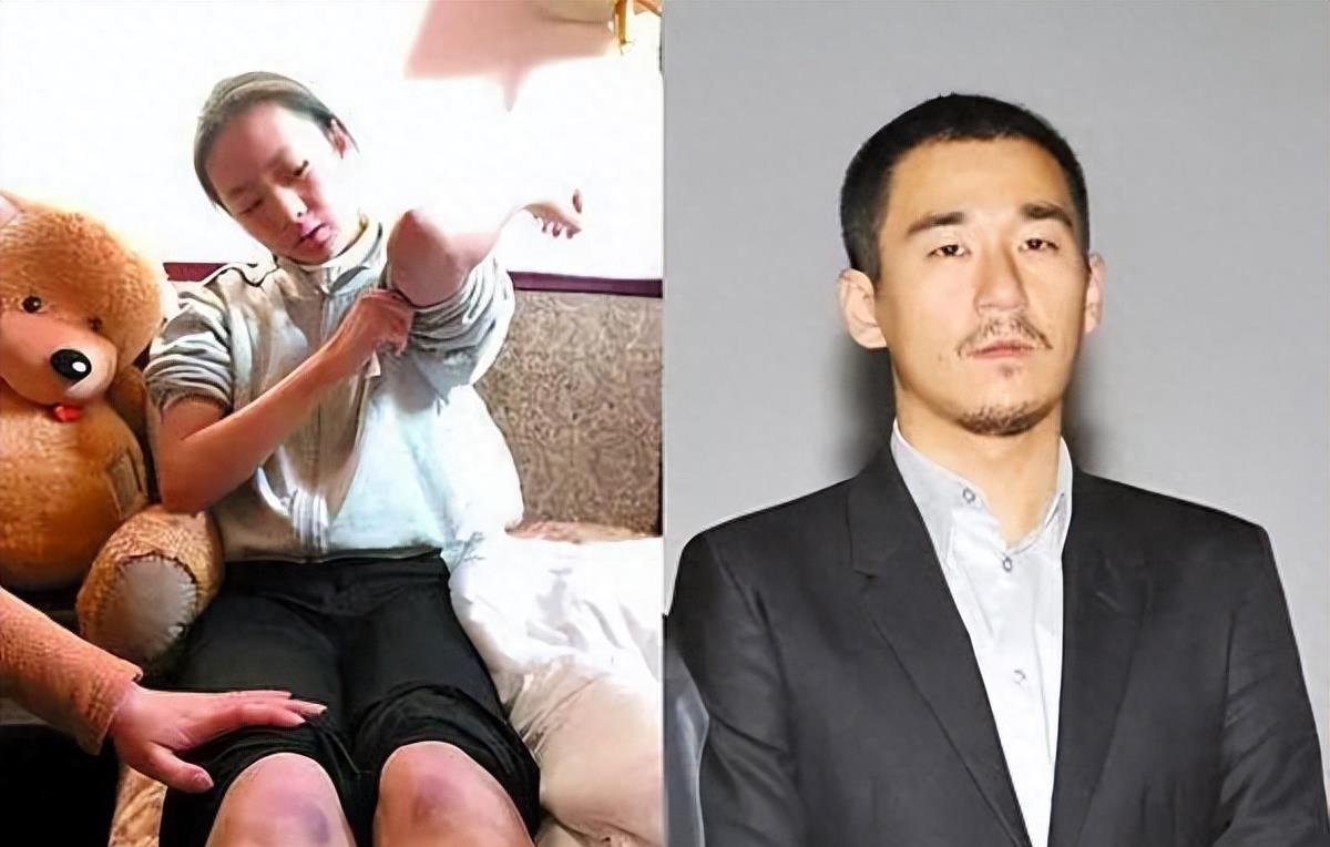 Female celebrities also suffer domestic violence! Beaten into inhuman ...