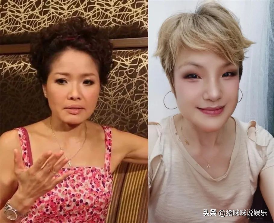 After being disfigured in a car accident and falling into depression ...