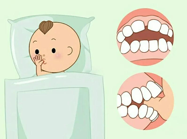 Should children be stopped from sucking their fingers? - iNEWS